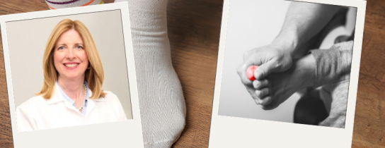 Why Are My Toes Discolored? | Crystal Run Healthcare