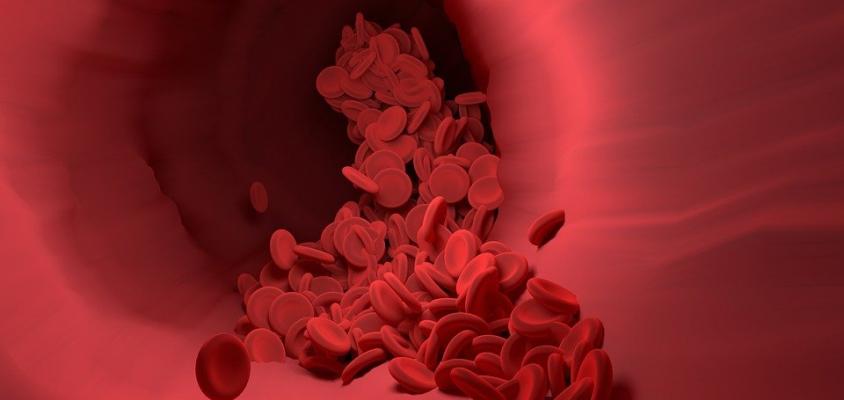 Blood Clot Causes, Symptoms & Treatment | Crystal Run Healthcare